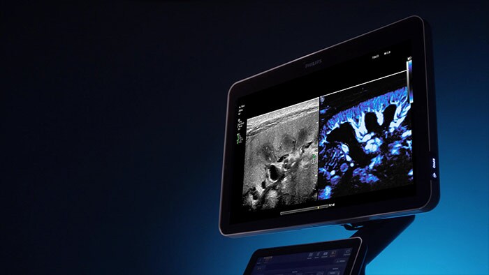 Découvrez les produits Philips