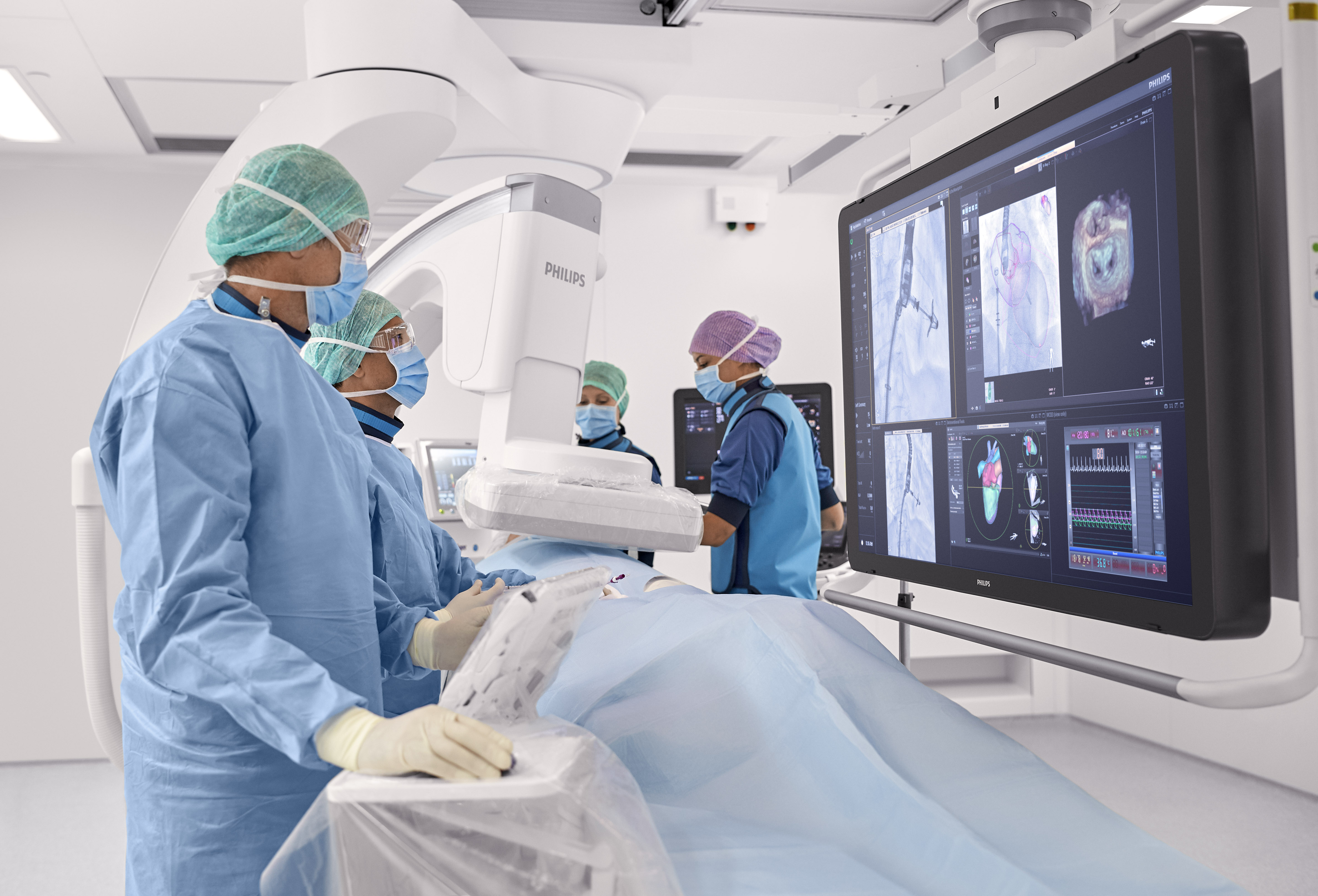 Philips lanceert Azurion met FlexArm - Nieuws | Philips